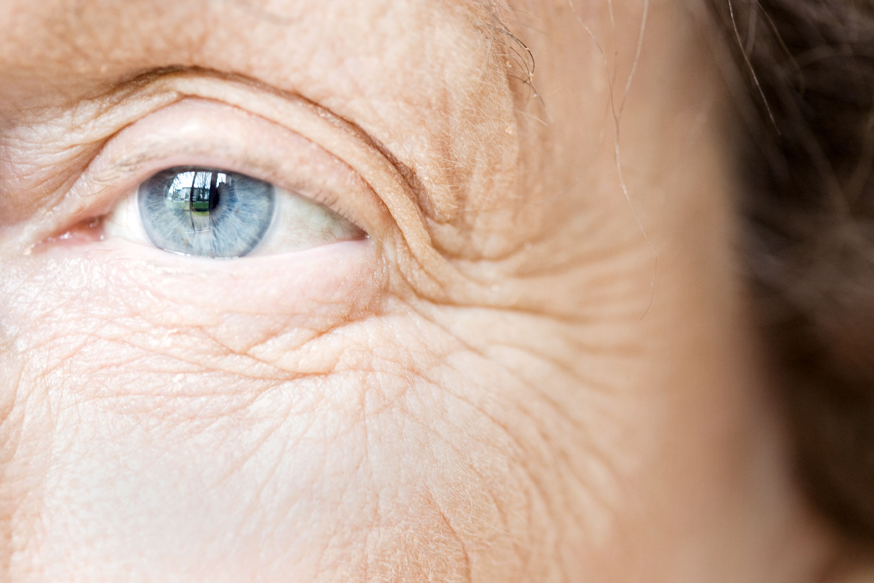 Cataracts: Surgery and lens options - Mayo Clinic Press